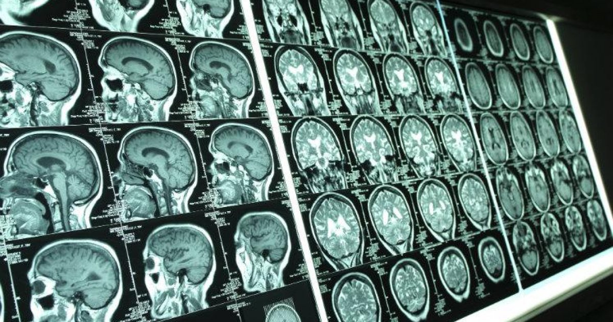Neuroscience is unlocking mysteries of the teenage brain Neuroscience is unlocking mysteries of the teenage brain