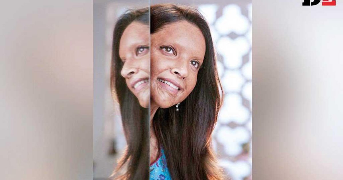 Deepika Padukone appears as an acid attack survivor in ‘Chhapaak’