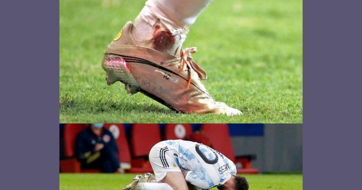 Images of a bleeding Messi during semifinal against Colombia goes viral