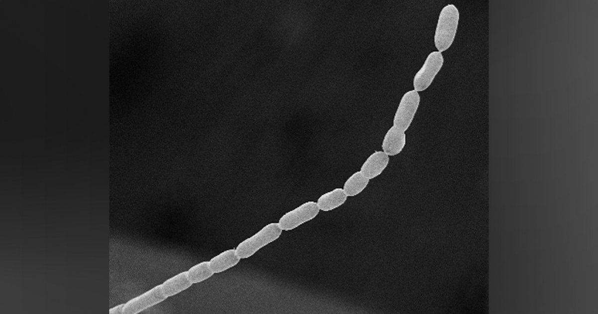 World's largest bacteria discovered in Guadeloupe