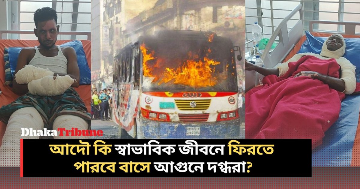 আদৌ কি স্বাভাবিক জীবনে ফিরতে পারবে বাসে আগুনে দগ্ধরা?