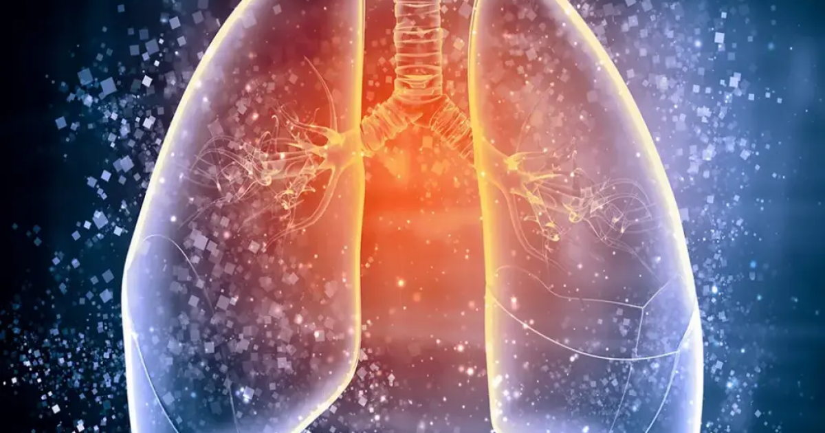 Tb Detection Bring Lab To People Not People To Lab