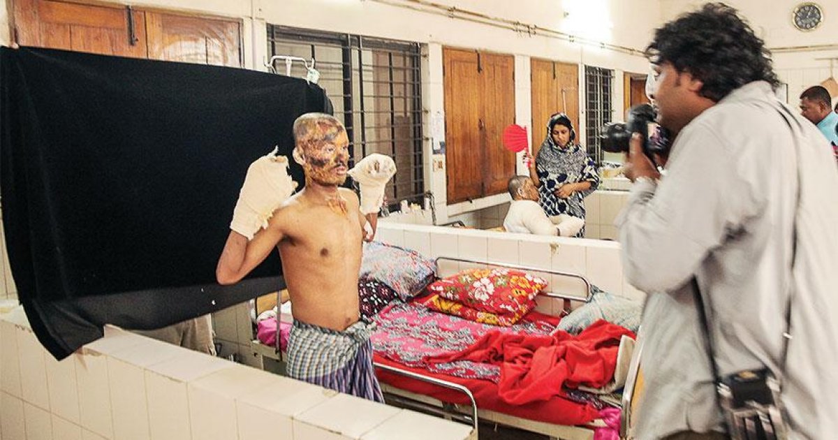 Freelance photographer asks burn victims to pose for shoot