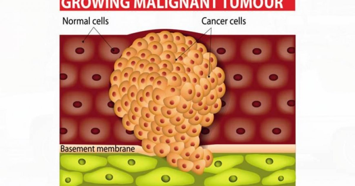 Tumour genetics reveal cancer treatment revolution