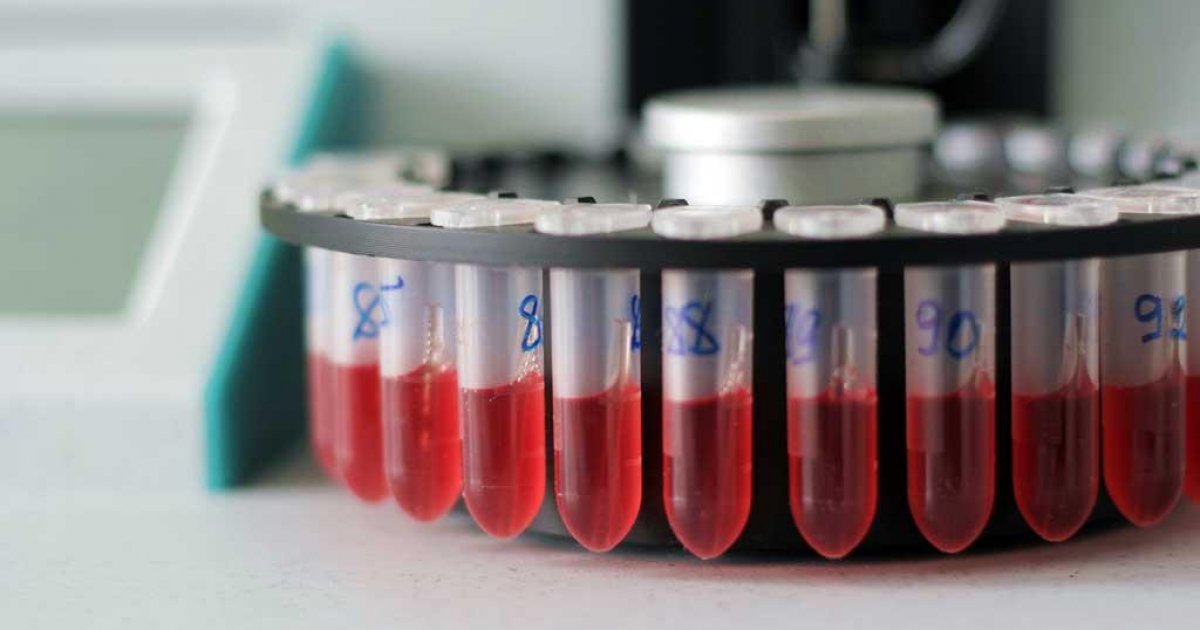 HC: Why blood test not mandatory before marriage or government job