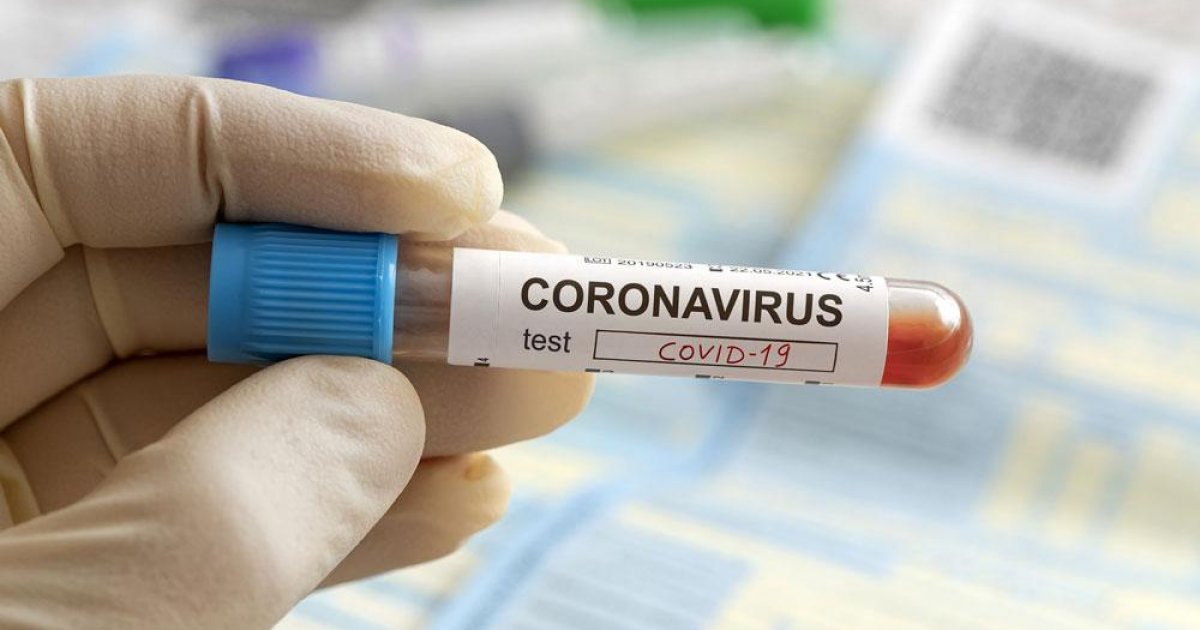 BCSIR: Bangladesh completes genome sequencing of 500 SARS-Cov-2 samples