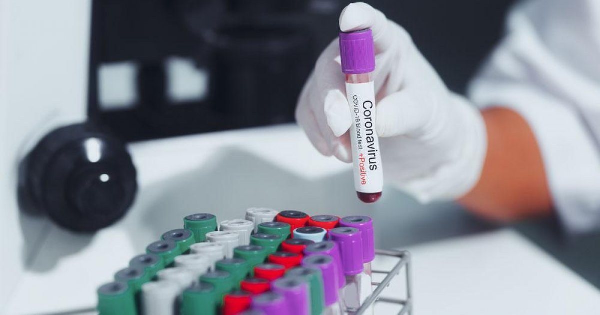 BCSIR: Coronavirus came to Bangladesh from Europe