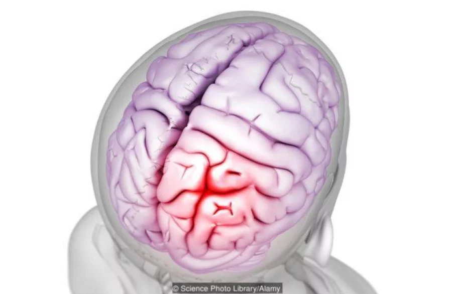 Why our ancestors drilled holes in each other's skulls